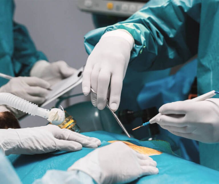 ZSR Stitchless Circumcision Surgery in Surat | Elegance Clinic