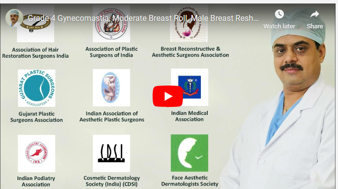 Type 4 Gynecomastia Treatment in Surat | Elegance Clinic